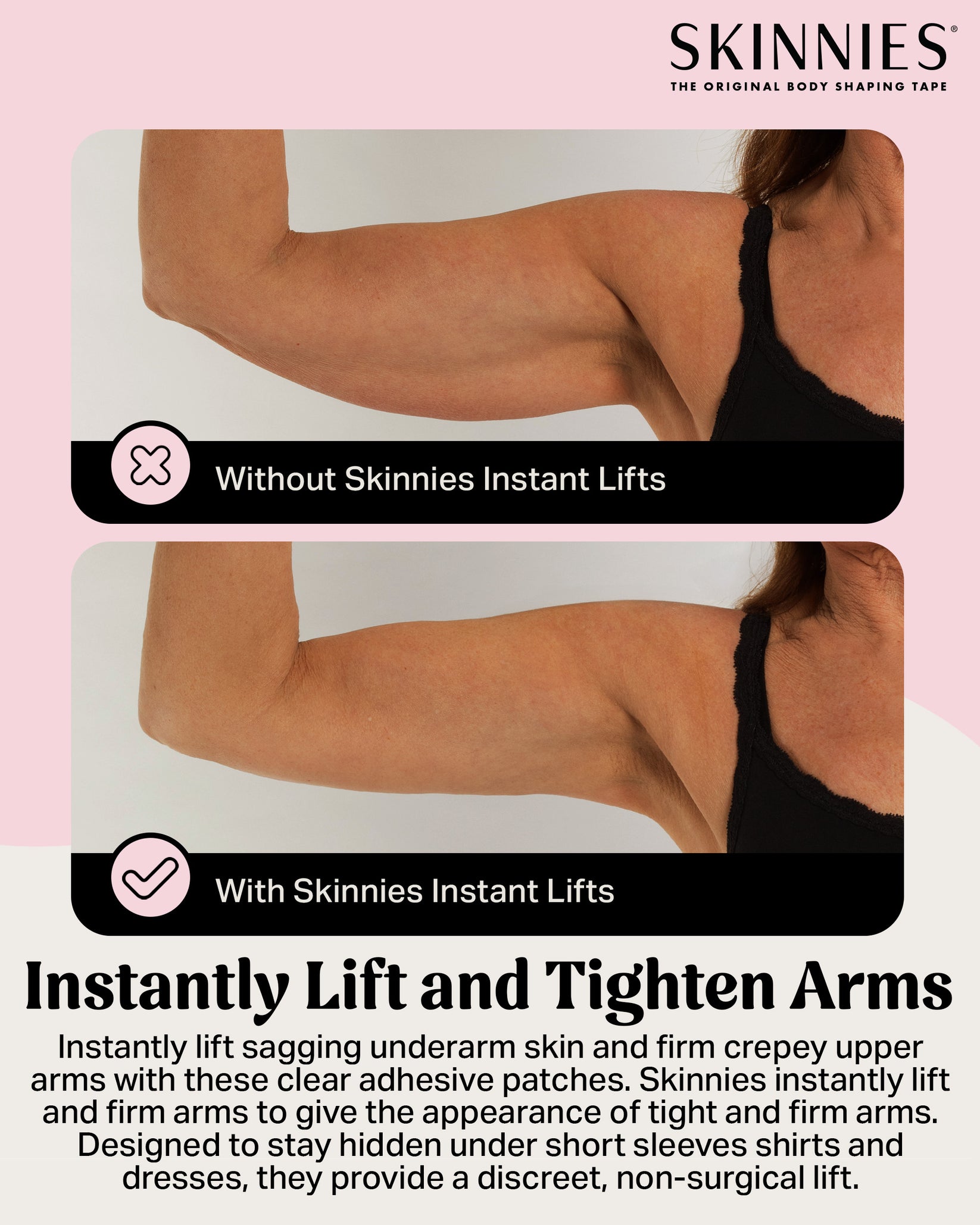 Skinnies Instant Arm Lifting Tape – skinniesinstantlifts