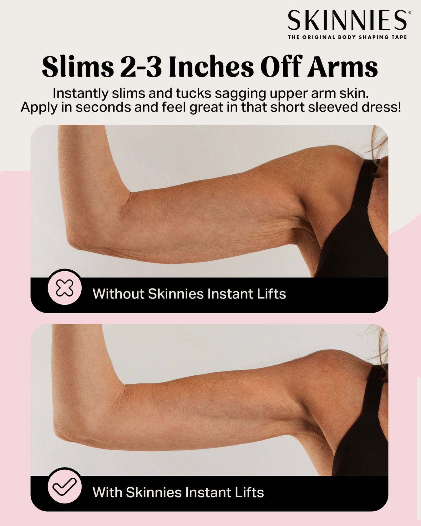 Skinnies Instant Arm Lifting Tape – skinniesinstantlifts