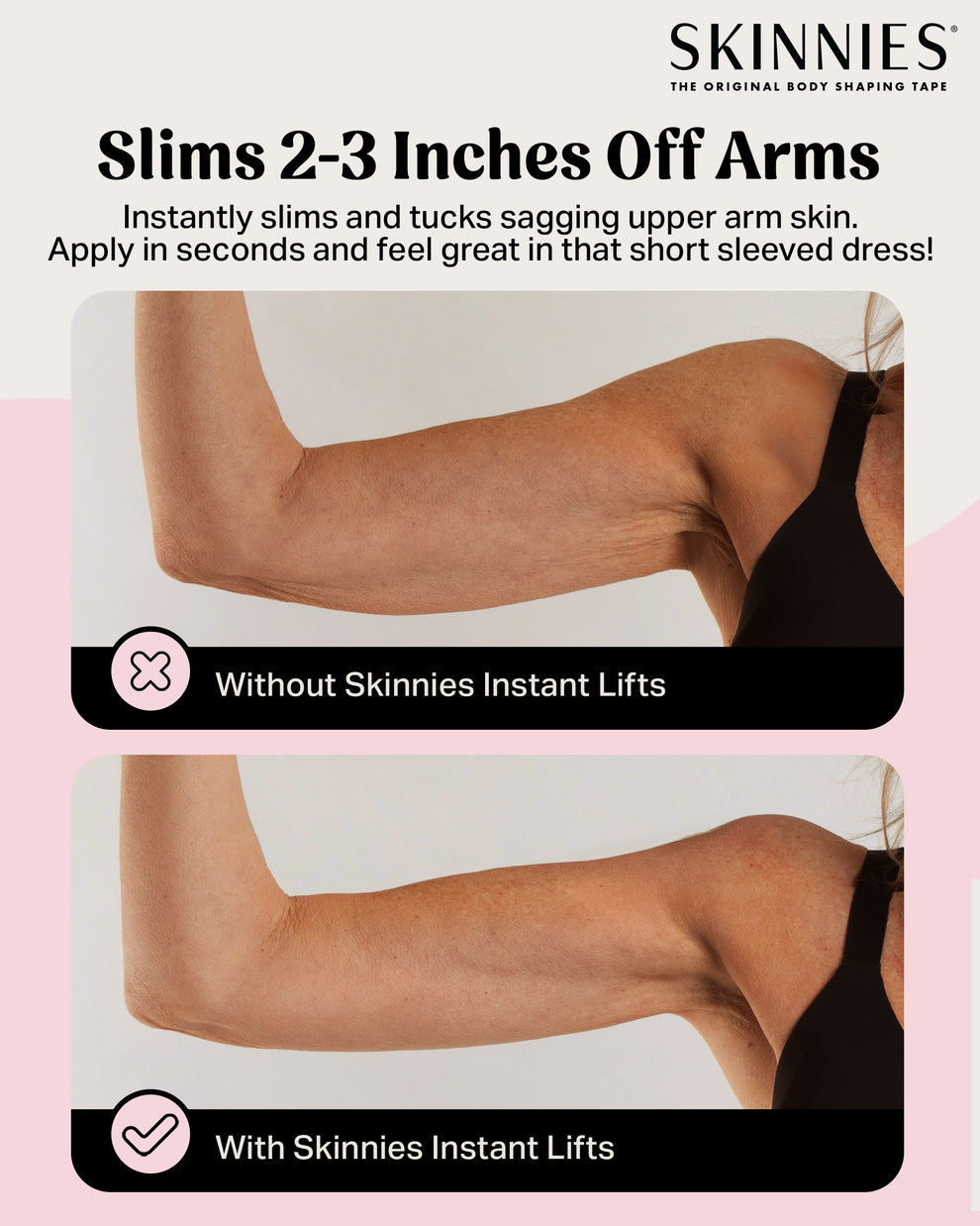 Skinnies Instant Arm Lifting Tape – skinniesinstantlifts